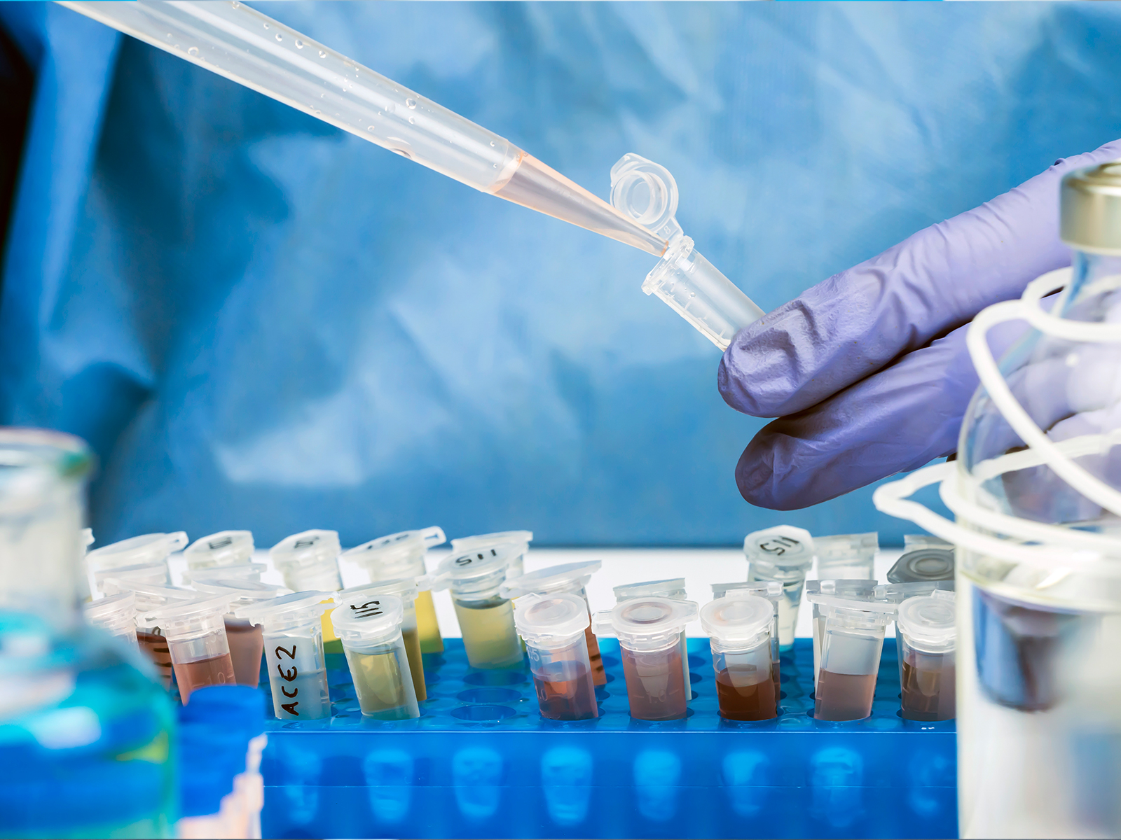 Wastewater Samples | Scilogex